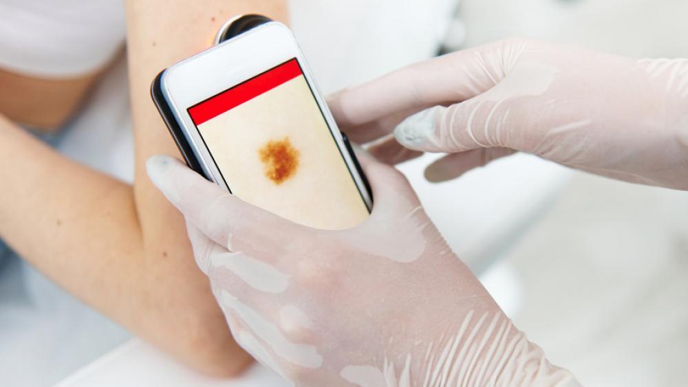 Hautkrebs mit einer App erkennen: Ist das überhaupt möglich ...